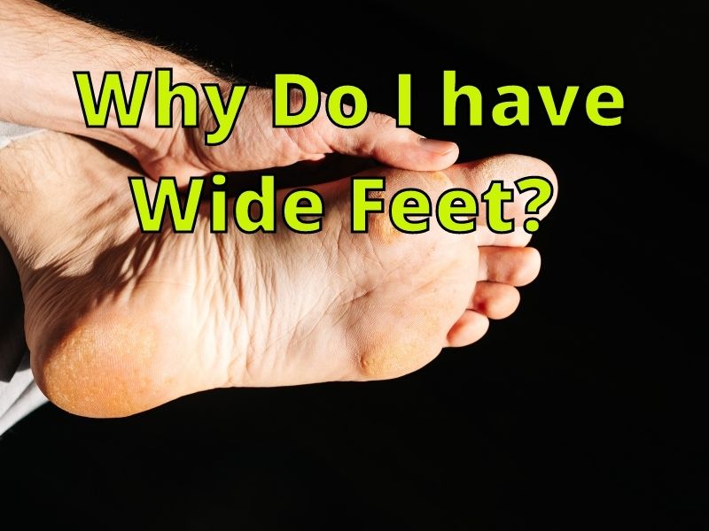 Why Do I Have Wide Feet Help Shoe